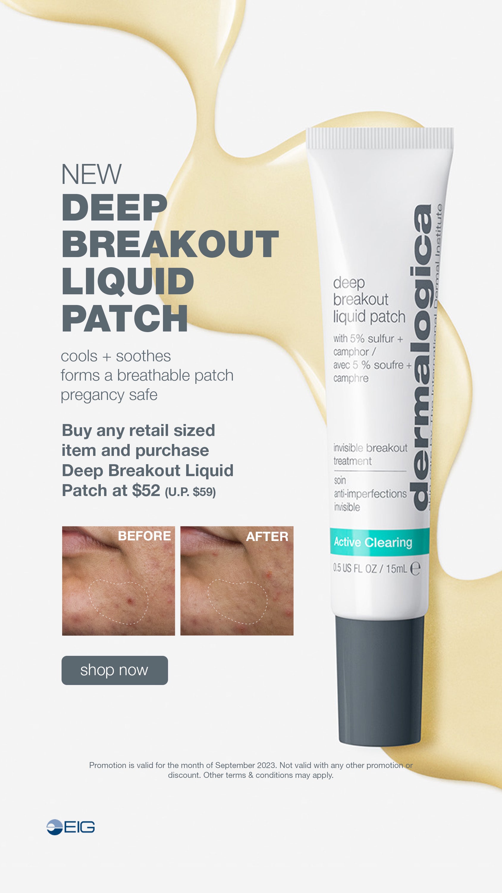 Dermalogica® Singapore | Official Website – Dermalogica Singapore